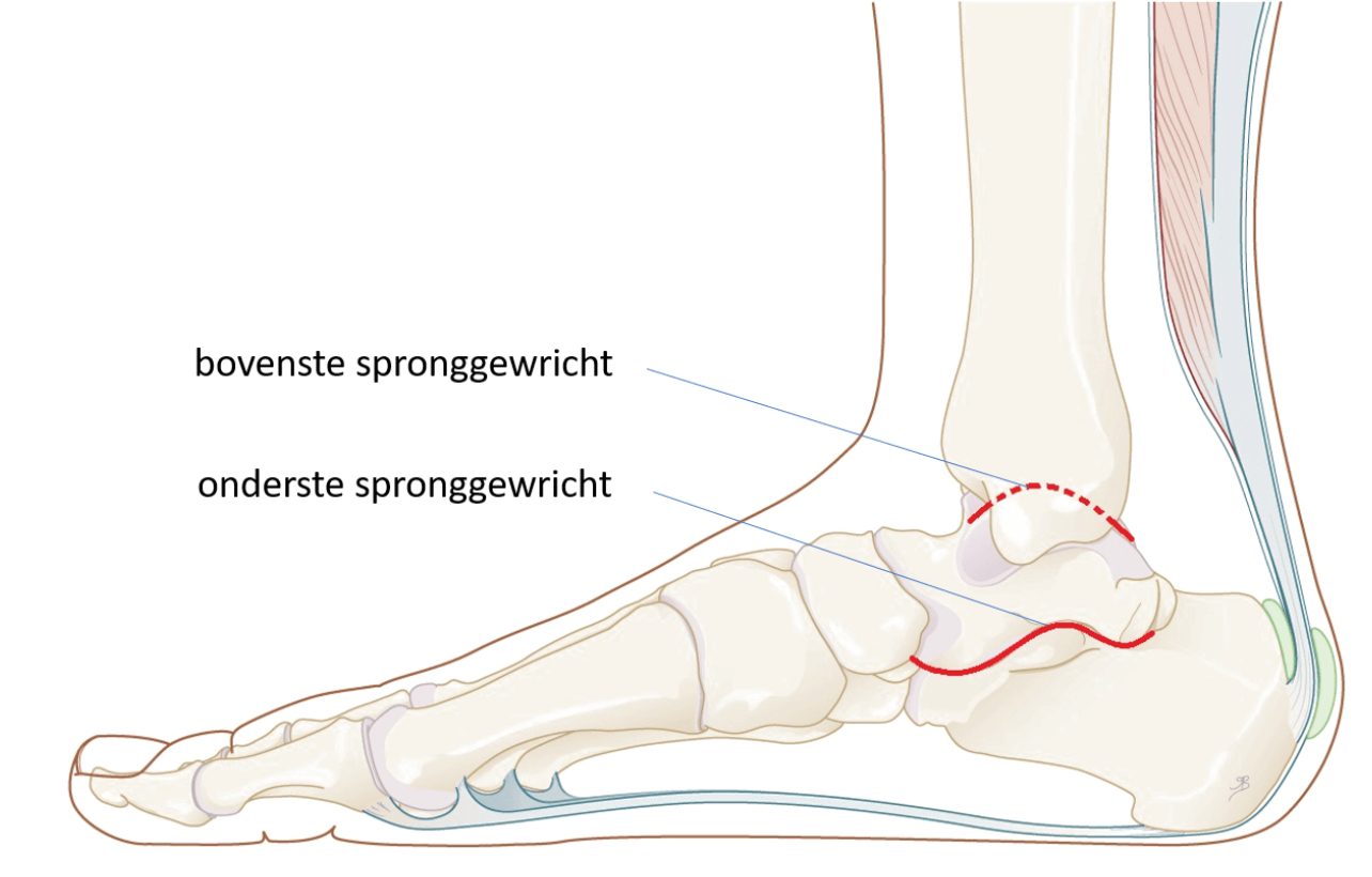 Enkelpijn of pijn in enkel verhelpen? Wij hebben oplossingen